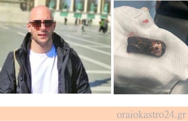 Μάχη για τη ζωή του συνεχίζει να δίνει ο 31χρονος αστυνομικός ...